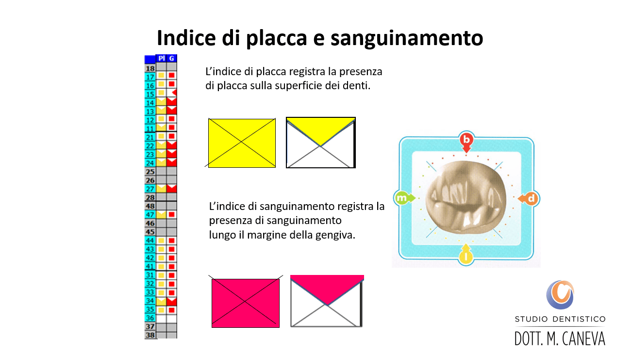 Studio Dentistico Caneva - La Cartella Parodontale: Un Approccio ...